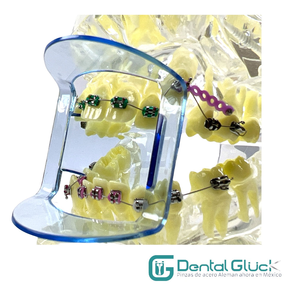 ABREBOCAS BOLA – Dental Glück®